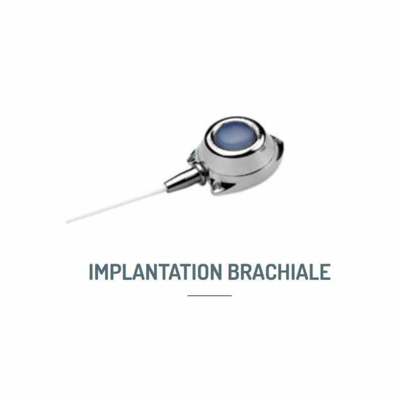 chambre implantable CIP pour chimiothérapie | Tunisie
