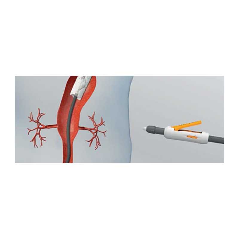 E-nside TAAA Thoracoabdominal Endoprosthesis | Tunisia