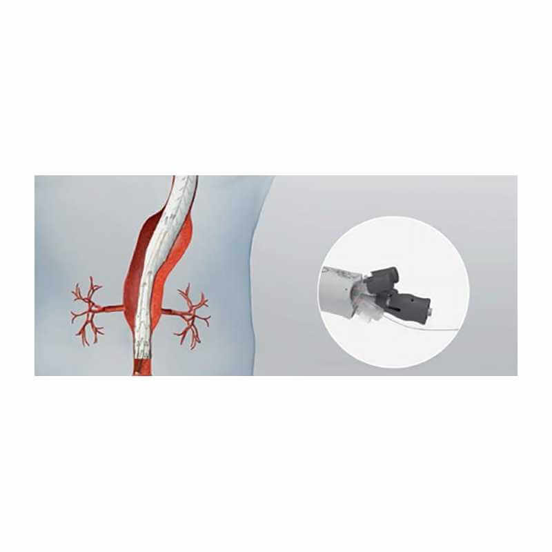 E-nside TAAA Thoracoabdominal Endoprosthesis | Tunisia