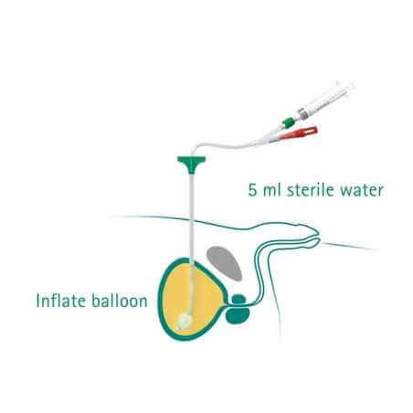 Puncture set for suprapubic bladder drainage | Tunisia