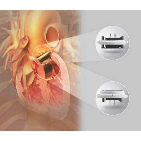 Prosthetic heart valve - prosthesis On-X | Biomedica Tunisia