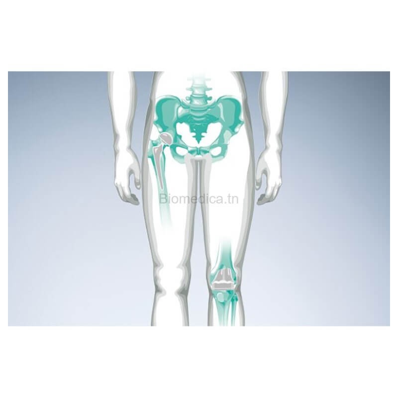 hip prosthesis | Biomedica Tunisia