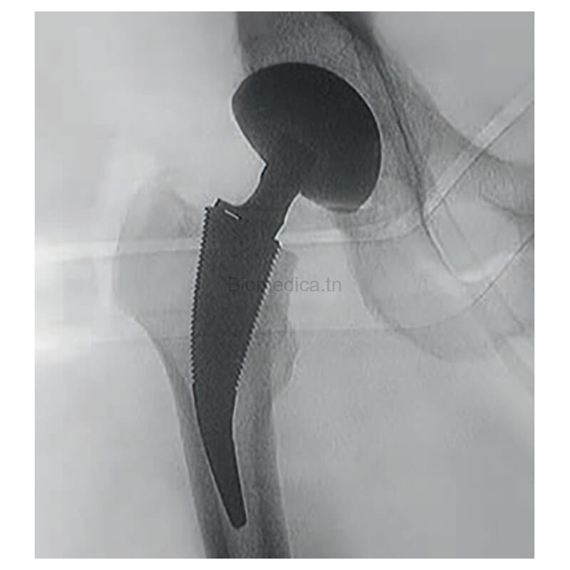 hip prosthesis | Biomedica Tunisia