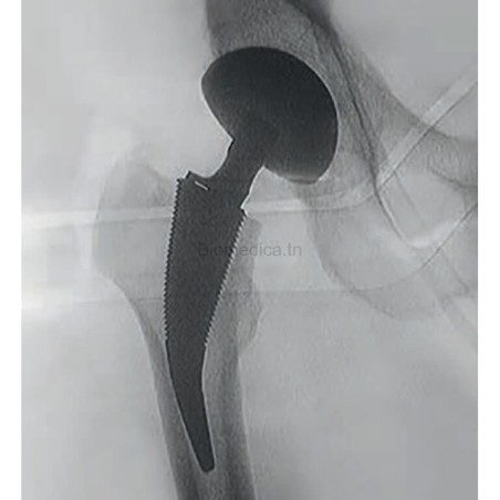 hip prosthesis | Biomedica Tunisia