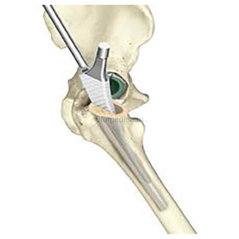 hip prosthesis | Biomedica Tunisia